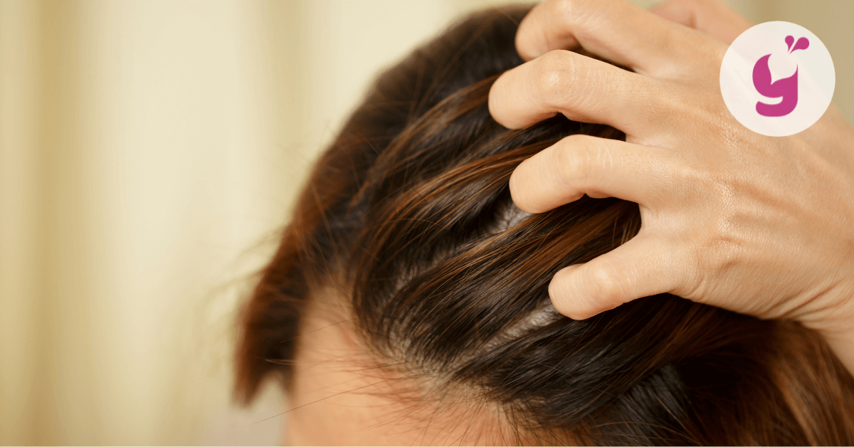 Seborea / seboroická dermatitída: Čo na ňu pomôže?